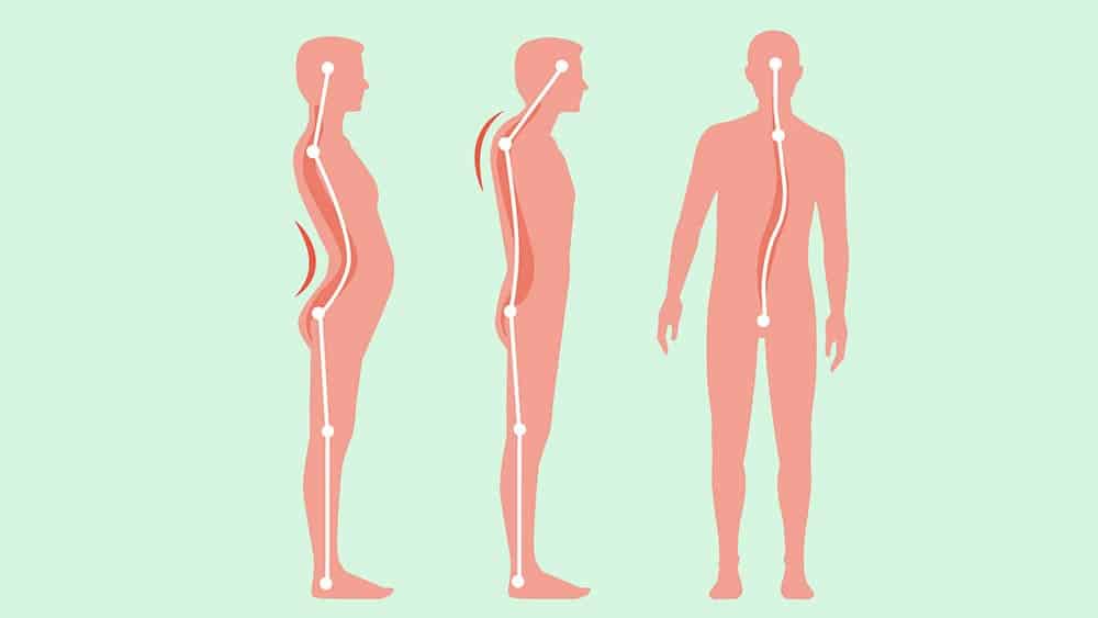 O que é Reeducação Postural Global - RPG para dor na coluna?